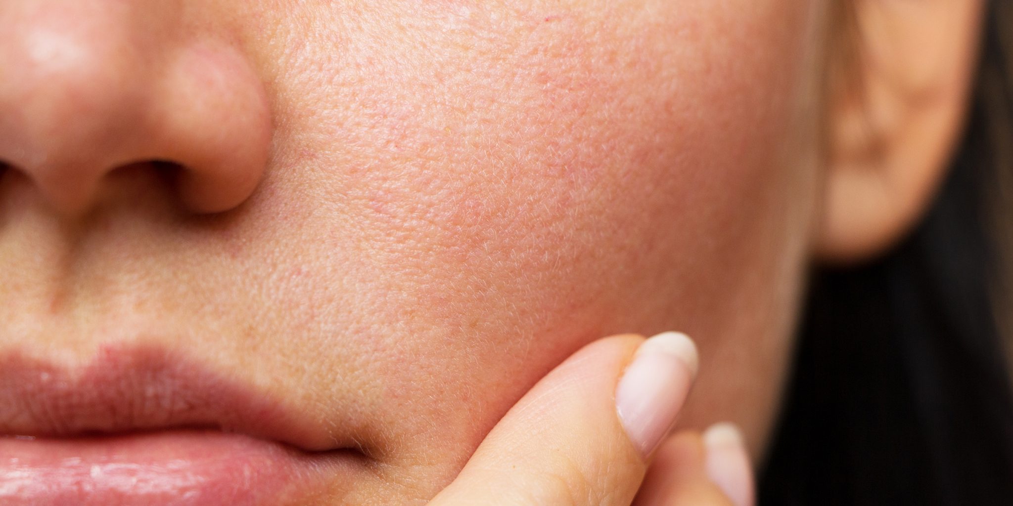 13 Facts About Retinols Before You Start Using It For Beautiful Skin ...