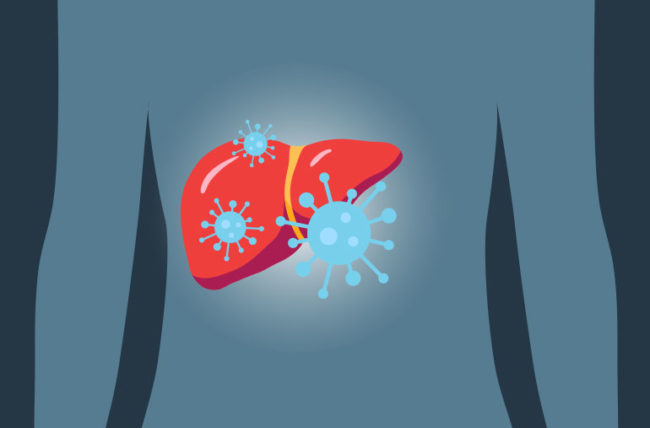 10 Possible Causes of Liver Pain and Facts You Need To Know ...